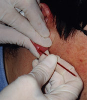 Untitled [www.lactate.com]